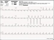 C# ECG Toolkit download | SourceForge.net