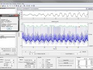 ECG Viewer download | SourceForge.net