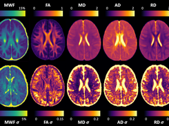 Pediatric MRI Myelin+Diffusion Atlas download | SourceForge.net