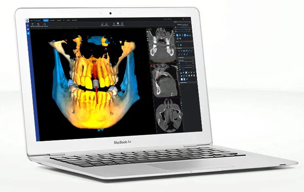 Planmeca Romexis Reviews in 2025