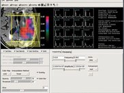SIVIC download | SourceForge.net