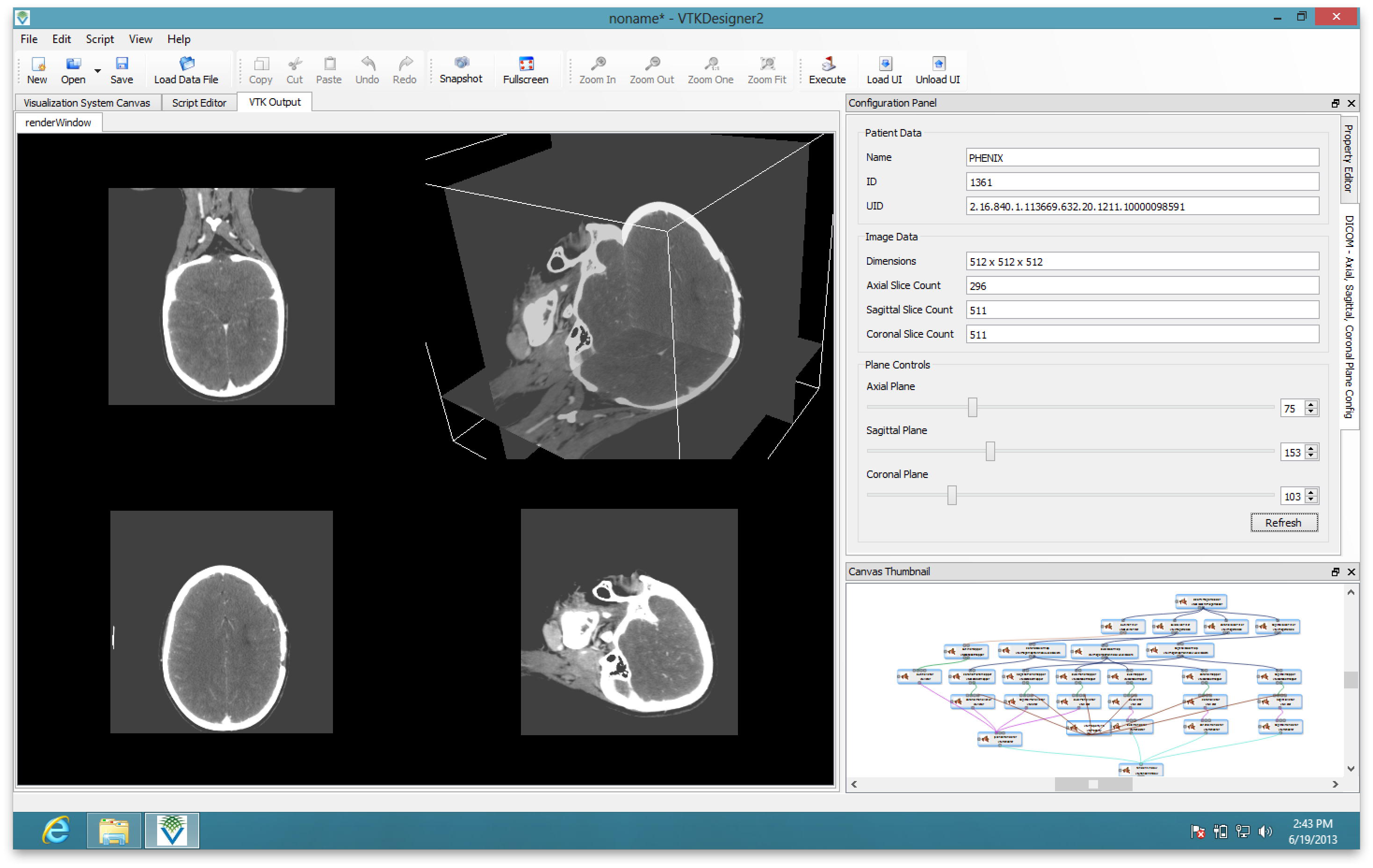 VTK Designer download | SourceForge.net