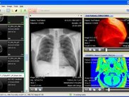 wxWidgets download | SourceForge.net